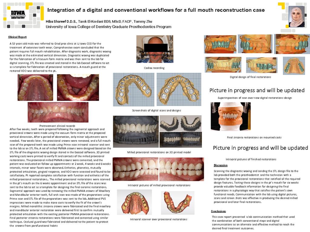 The American Prosthodontic Society - Integration of digital and ...